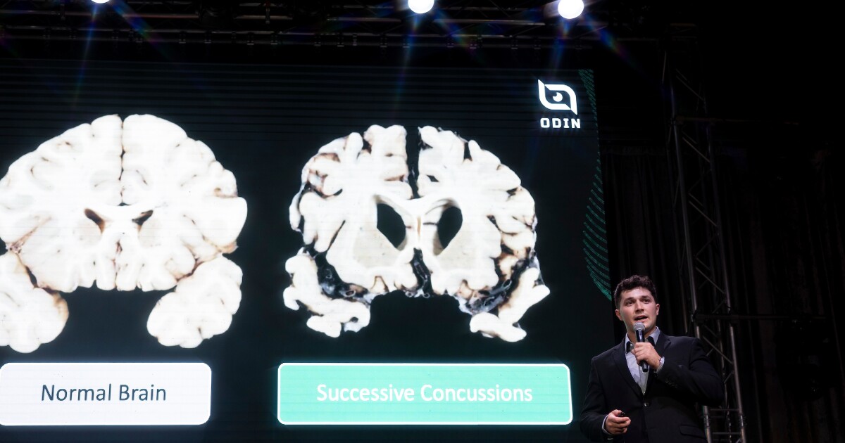 New concussion evaluation technology driven by former Cal Poly football ...