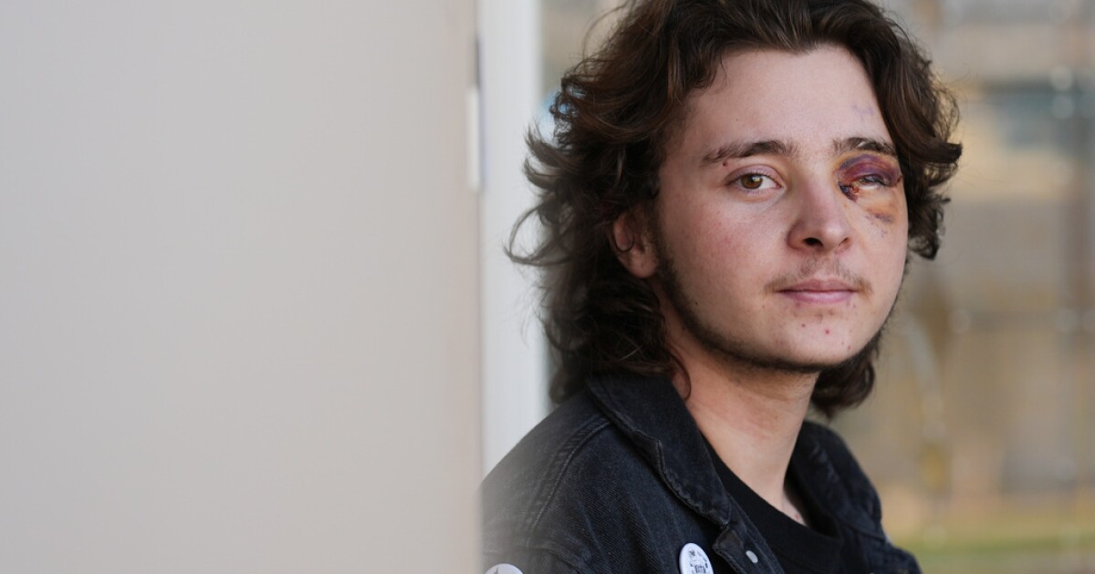 Man injured after federal agent fired projectile during California protest