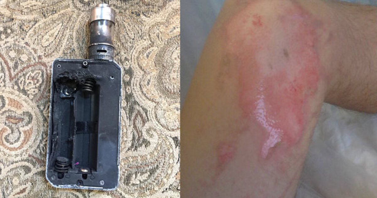 mechanical vape explosion