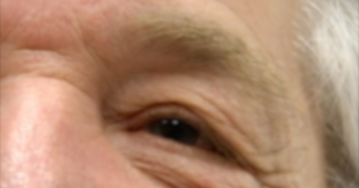Plastic surgeons seeing dramatic increase in facial procedures due to ...